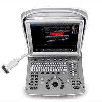 China 12 Inch LED Chison Portable Ultrasound Machine ECO6 With Long Battery Life for sale