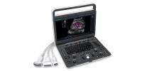 China 7 Imaging Levels SonoScape E3 Portable Ultrasound Machine With 15.6 Inch Monitor for sale