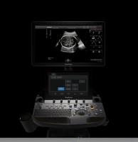 China 13.3 Inch LCD Trolley SonoScape Ultrasound Machine P60 AI Based for sale