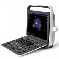 China Anti Glare Screen 2D Portable SonoScape Ultrasound Machine S8 Exp for sale
