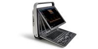 China Anti Glare Screen 2D Portable SonoScape Ultrasound Machine S8 Exp for sale