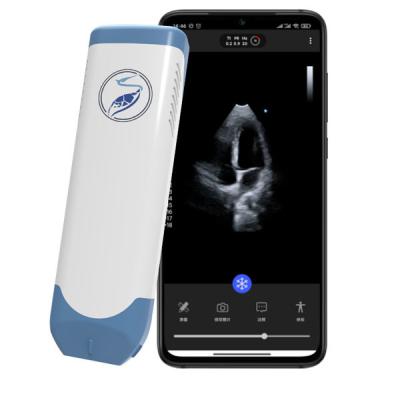 China Wireless Phased Array Handheld Ultrasound Scanner 5MHz Pocket Cardiac Ultrasound for POCUS Echocardiography for sale