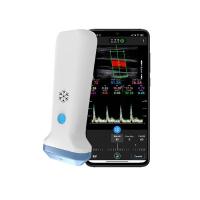 China Linear Probe Wireless Ultrasound Machine Portable 4MHz 8.3MHz 12MHz for sale
