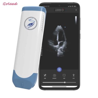 China 3.6MHz Portable Wireless Ultrasound Probe Phased Array Transducer for sale