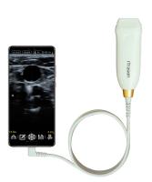 China 64 Channel 20mm Depth Handheld Ultrasound Scanner For Peripheral Vascular Assessment and Ultrasound-Guided Vascular Access for sale
