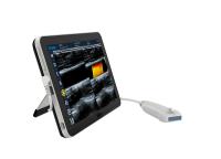 China 128 Element Mobile USB Cable Connection Handheld Ultrasound Scanner For Laptop for sale