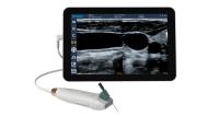China Handheld Ultrasound Scanner with 12MHZ High Frequency Linear Probe for Accurate Vascular Access and PICC Insertion Procedures for sale