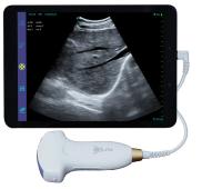 China Electronic Convex Array Color Doppler Handheld Ultrasound Scanner 3.5MHz for sale