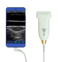 China 10MHz Portable Wireless Android Ultrasound Scanner With Type-C Connection for sale