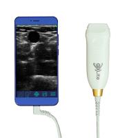 China Handheld Ultrasound Scanner with 12MHZ High Frequency Linear Probe for Accurate Vascular Access and PICC Insertion Procedures for sale