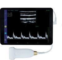 China 10MHz Portable Wireless Android Ultrasound Scanner With Type-C Connection for sale