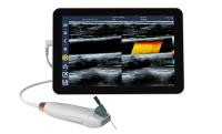 China Handheld Ultrasound Scanner with 12MHZ High Frequency Linear Probe for Accurate Vascular Access and PICC Insertion Procedures for sale
