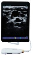 China 128 Element Mobile USB Cable Connection Handheld Ultrasound Scanner For Laptop for sale