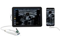 China 64 Channel 20mm Depth Handheld Ultrasound Scanner For Peripheral Vascular Assessment and Ultrasound-Guided Vascular Access for sale