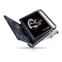 China 128 Element Wifi Ultrasound Chison EBit 60 For Cardiovascular for sale