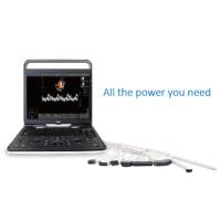 China 128 Element Wifi Ultrasound Chison EBit 60 For Cardiovascular for sale