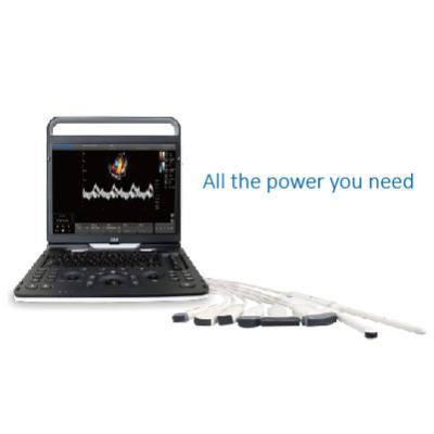 China 128 Element Wifi Ultrasound Chison EBit 60 For Cardiovascular for sale