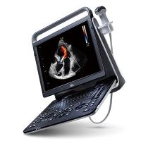 China 128 Element Wifi Ultrasound Chison EBit 60 For Cardiovascular for sale