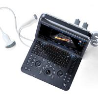China 128 Element Wifi Ultrasound Chison EBit 60 For Cardiovascular for sale