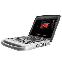 China 120° Rotatable Chison SonoBook 6 Portable Laptop Ultrasound Machine for sale