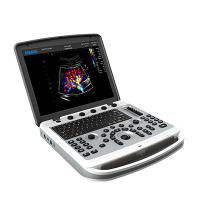 China 120° Rotatable Chison SonoBook 6 Portable Laptop Ultrasound Machine for sale