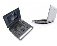 China Smart Sight 500GB Laptop SonoScape Ultrasound Machine With 15.6'' LCD for sale