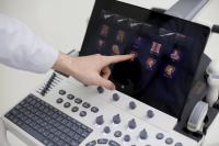 China 500GB SonoScape Ultrasound Machine P50 With Five Sockets for sale