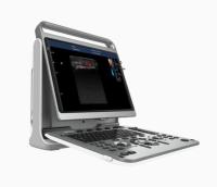 China Portable Cardiac Ultrasound Machine Chison EBit 50 16.5lbs for sale