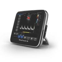 China 10.4 Touch Screen 16GB Portable Chison Ultrasound Machine Sonotouch 30 for sale