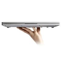 China 14.1'' Touch Screen Laptop Chison Ultrasound Machine JPG for sale
