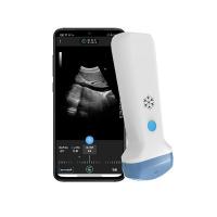 China HDMI Output Wireless Convex Handheld Ultrasound Scanner | 3.6MHz Portable Color Doppler POCUS Ultrasound for sale