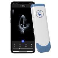 China Depth 18.9cm Handheld Ultrasound Scanner For Iphone 3.6MHz for sale
