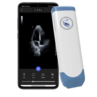 China Depth 18.9cm Handheld Ultrasound Scanner For Iphone 3.6MHz for sale