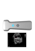 China Ultrasonication Convex Wireless Ultrasound Probe For Gynecology for sale