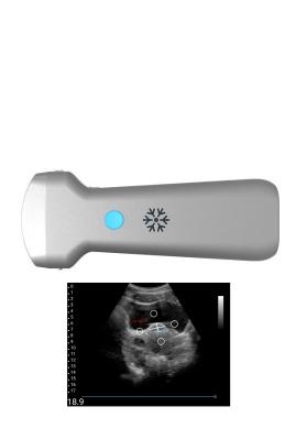China Ultrasonication Convex Wireless Ultrasound Probe For Gynecology for sale