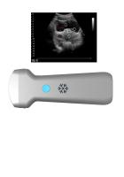 China 6000mAh 128 Elements Wifi Ultrasound USG Wireless USG Probe 12.6cm for sale