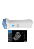 China Anesthesia Ipad Wireless Ultrasound Probe For POCUS Exams Primary Care for sale