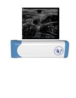 China 12MHz Handheld Wireless Ultrasound Probe For Outdoor Inspections for sale
