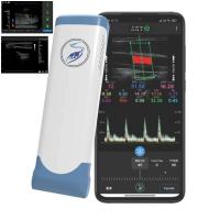 China 256 Scan Lines Ipad Ultrasound Transducer Wireless Ultrasound Probe For PICC for sale