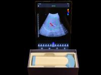China 128 Element Premium Pocket Size Wireless Ultrasound Probe For Emergency for sale