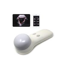 China Wireless 4D Portable Bladder Scanner for Point-of-Care Urinary Volume Measurement for sale