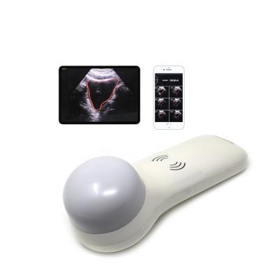 China Wireless 4D Portable Bladder Scanner for Point-of-Care Urinary Volume Measurement for sale