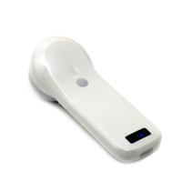China Wireless 4D Portable Bladder Scanner for Point-of-Care Urinary Volume Measurement for sale