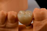 China Oral Implantology Self Tapping Single Tooth Dental Implants With Internal Hex Connection for sale