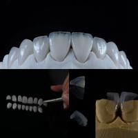 China Glass Ceramic Veneer Achieve a Natural-Looking Smile for sale