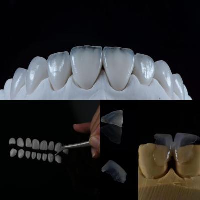 China Glass Ceramic Veneer Achieve a Natural-Looking Smile for sale