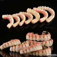 China Implant Crown and Bridge for Dental Reconstruction for sale