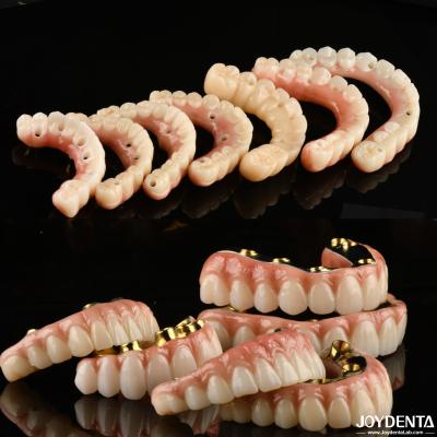 China Implant Crown and Bridge for Dental Reconstruction for sale