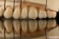 China Natural Looking Multilayer Full Zirconia For Dental Restorations Ultra Translucent for sale