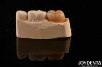 China Dental Restoration Material Multilayer Full Zirconia 1200 HV Hardness Crack Resistance for sale
